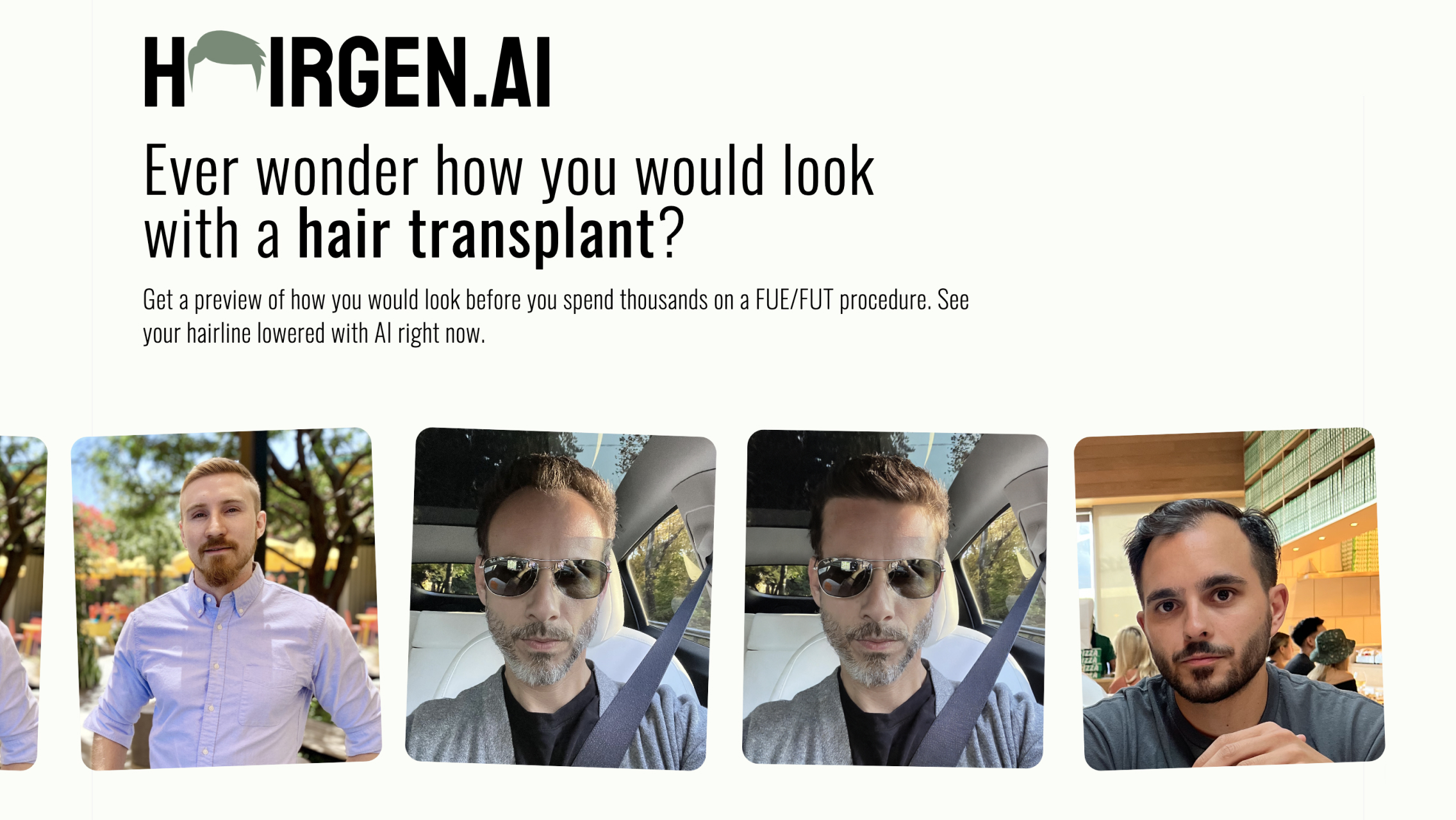 Hairgen AI - Transform your look with AI-powered hair transplant ...